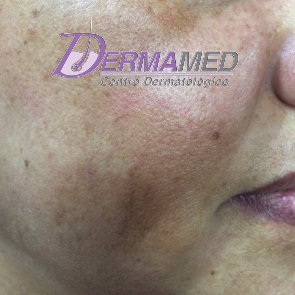 Dermatología Clínica - DERMAMED: Dermatólogos Guatemala